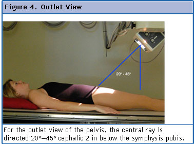 Pelvic Inlet View
